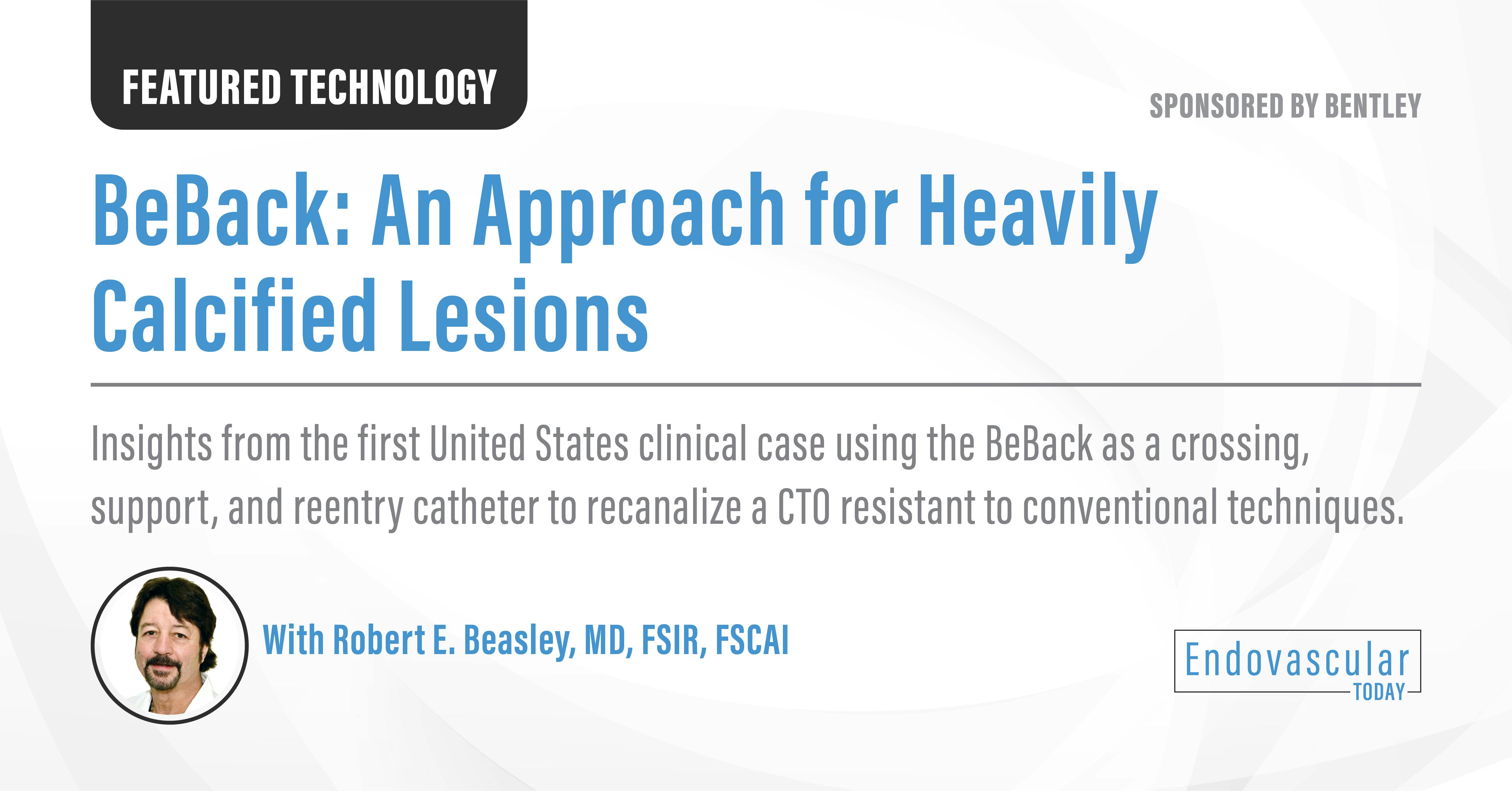 BeBack: An Approach for Heavily Calcified Lesions - Endovascular Today