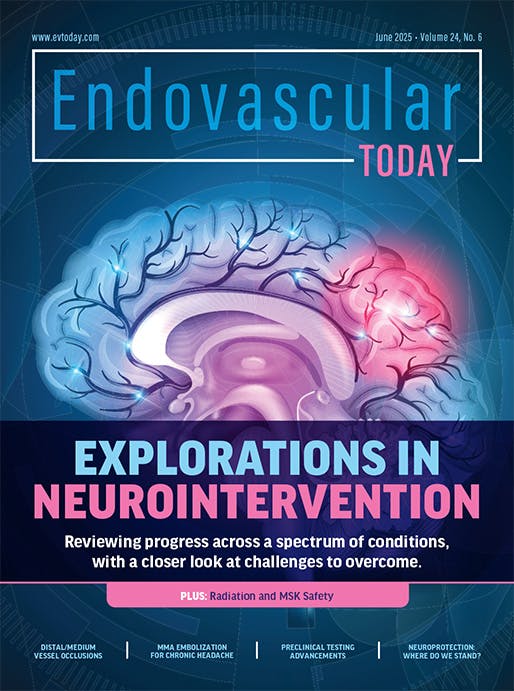 Shockwave’s Javelin IVL Catheter Evaluated in Pooled Data From Mini S ...