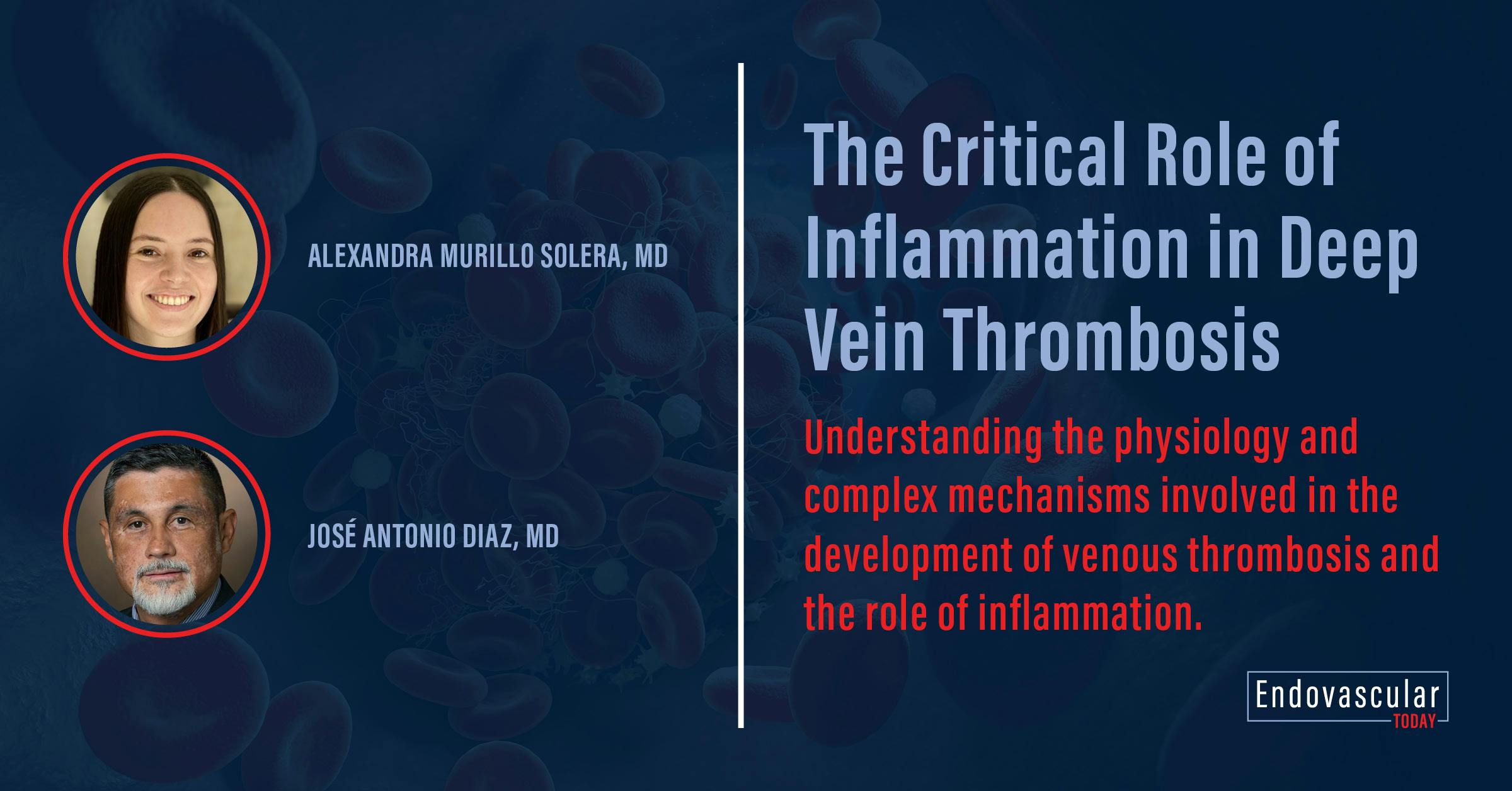 The Critical Role of Inflammation in Deep Vein Thrombosis ...