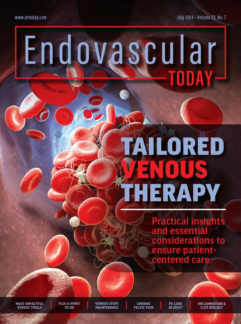 Venolymphatic Ulcers: What You Always Wanted to Know (But Didn’t Want ...