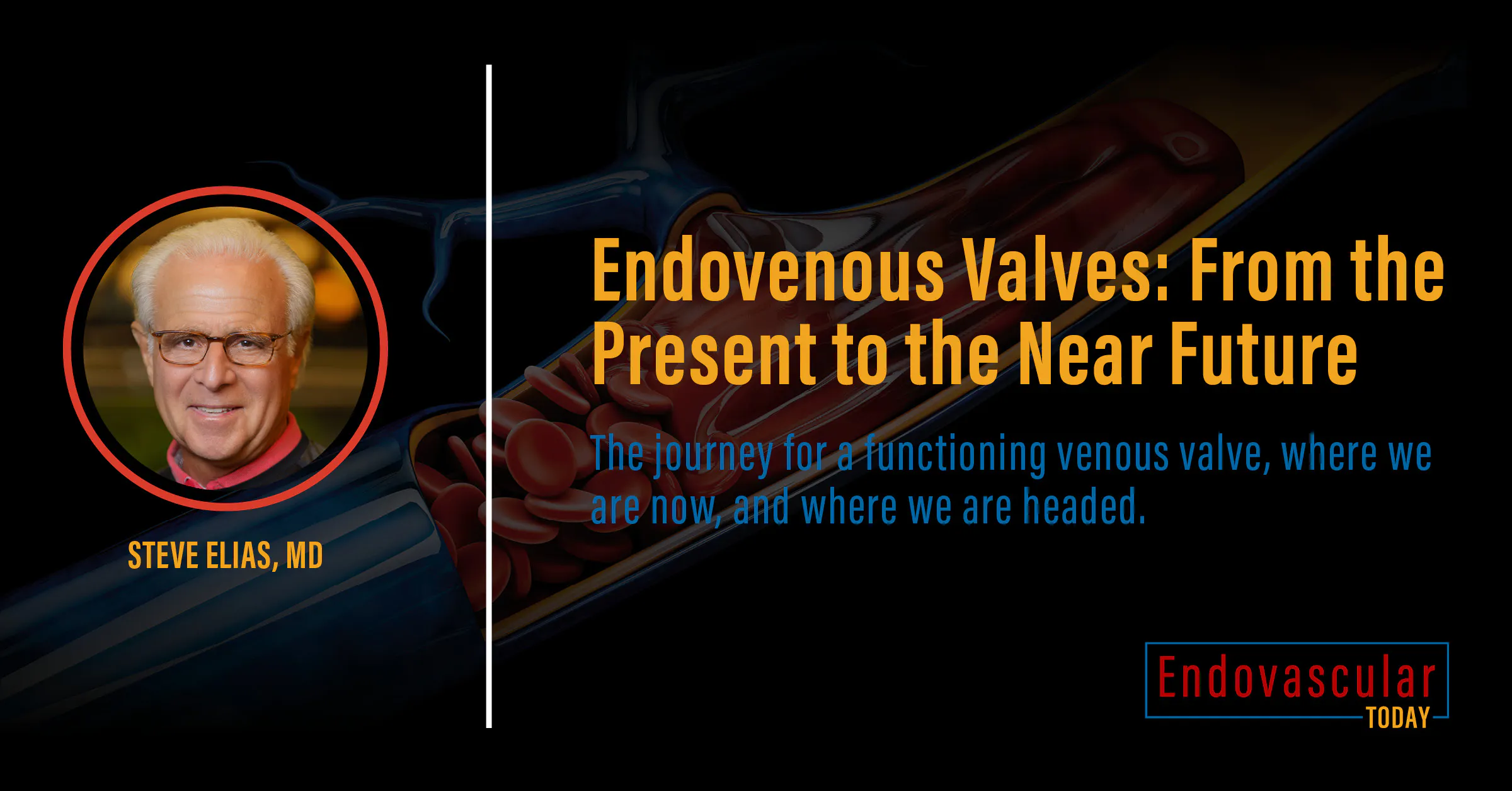 Endovenous Valves: From the Present to the Near Future - Endovascular Today