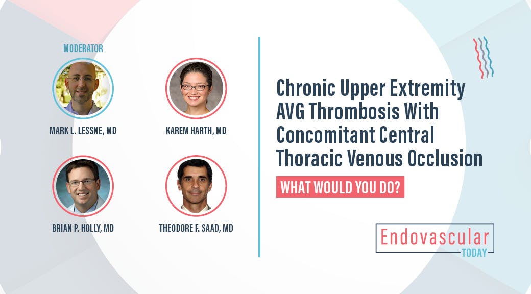 Chronic Upper Extremity AVG Thrombosis With Concomitant Central ...