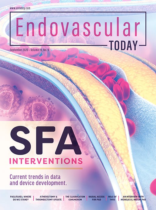 Update on SFA Interventions - Endovascular Today