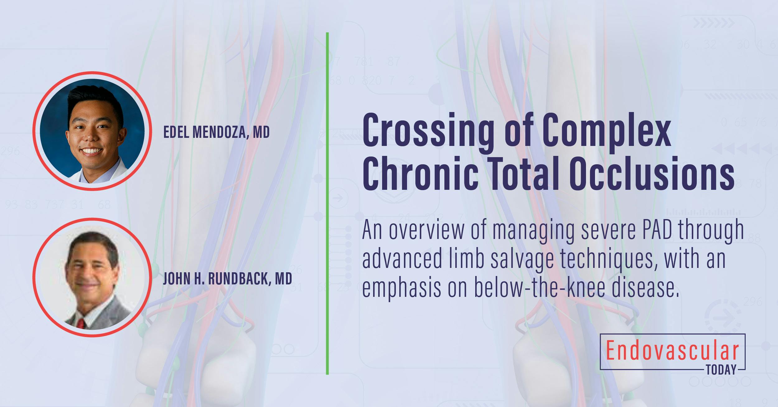 Crossing of Complex Chronic Total Occlusions - Endovascular Today
