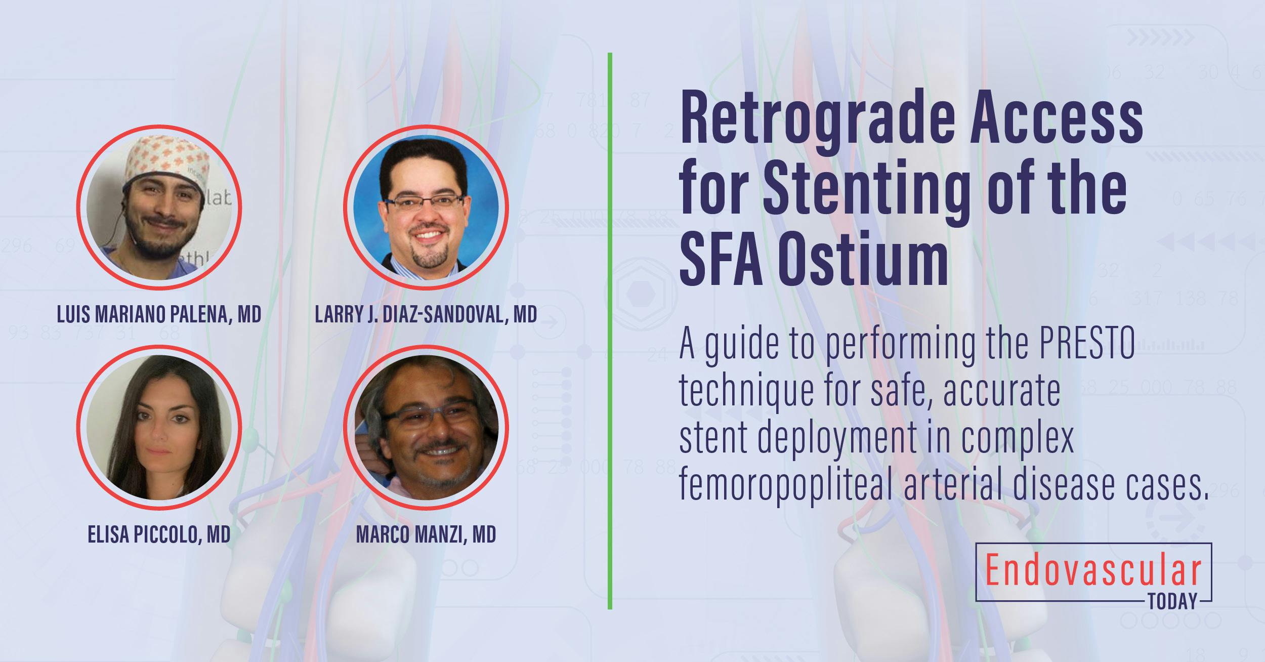 Retrograde Access for Stenting of the SFA Ostium - Endovascular Today