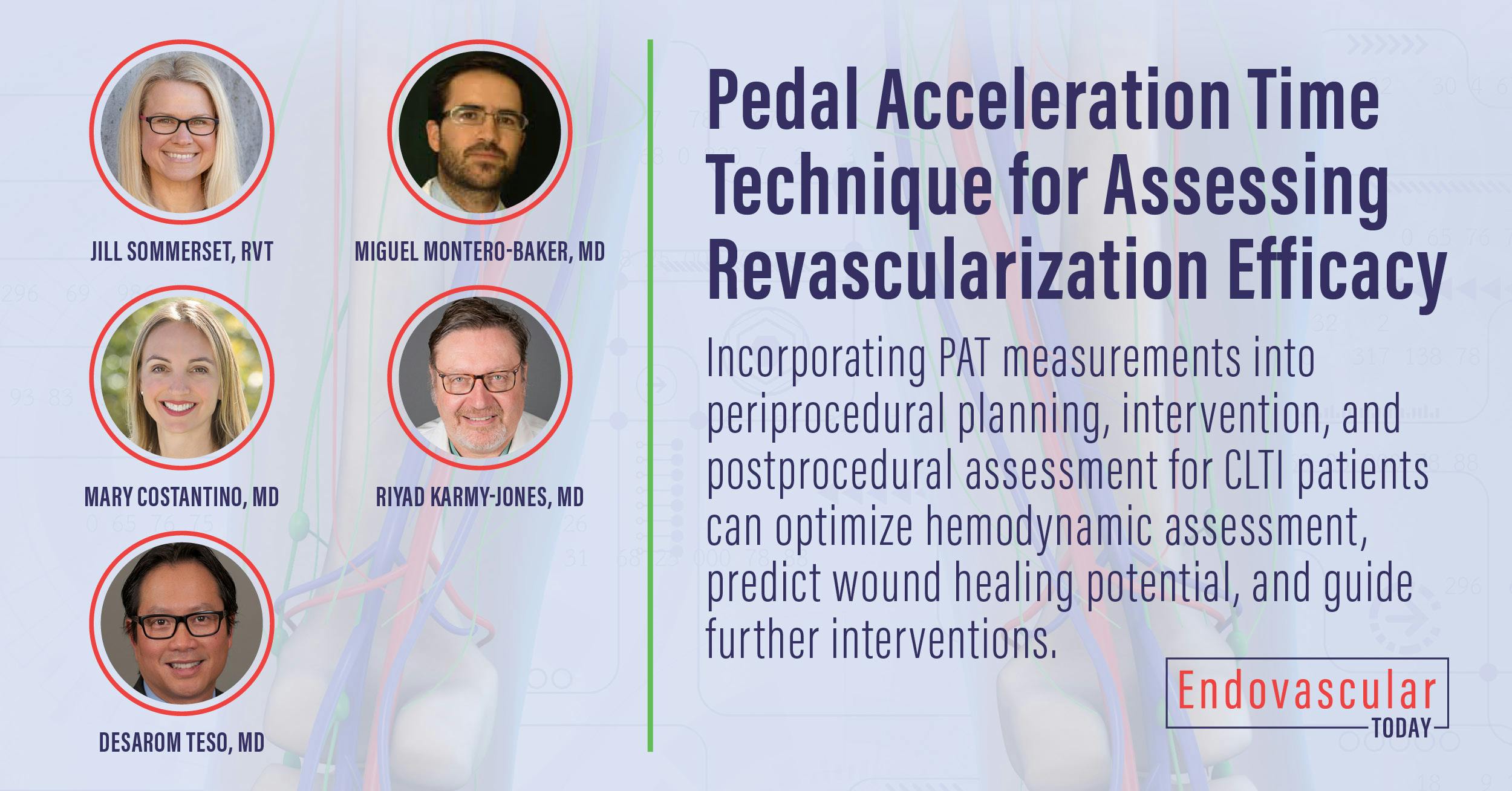 Pedal Acceleration Time Technique for Assessing Revascularization ...