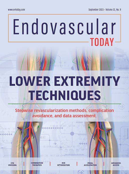 Pedal Acceleration Time Technique for Assessing Revascularization ...