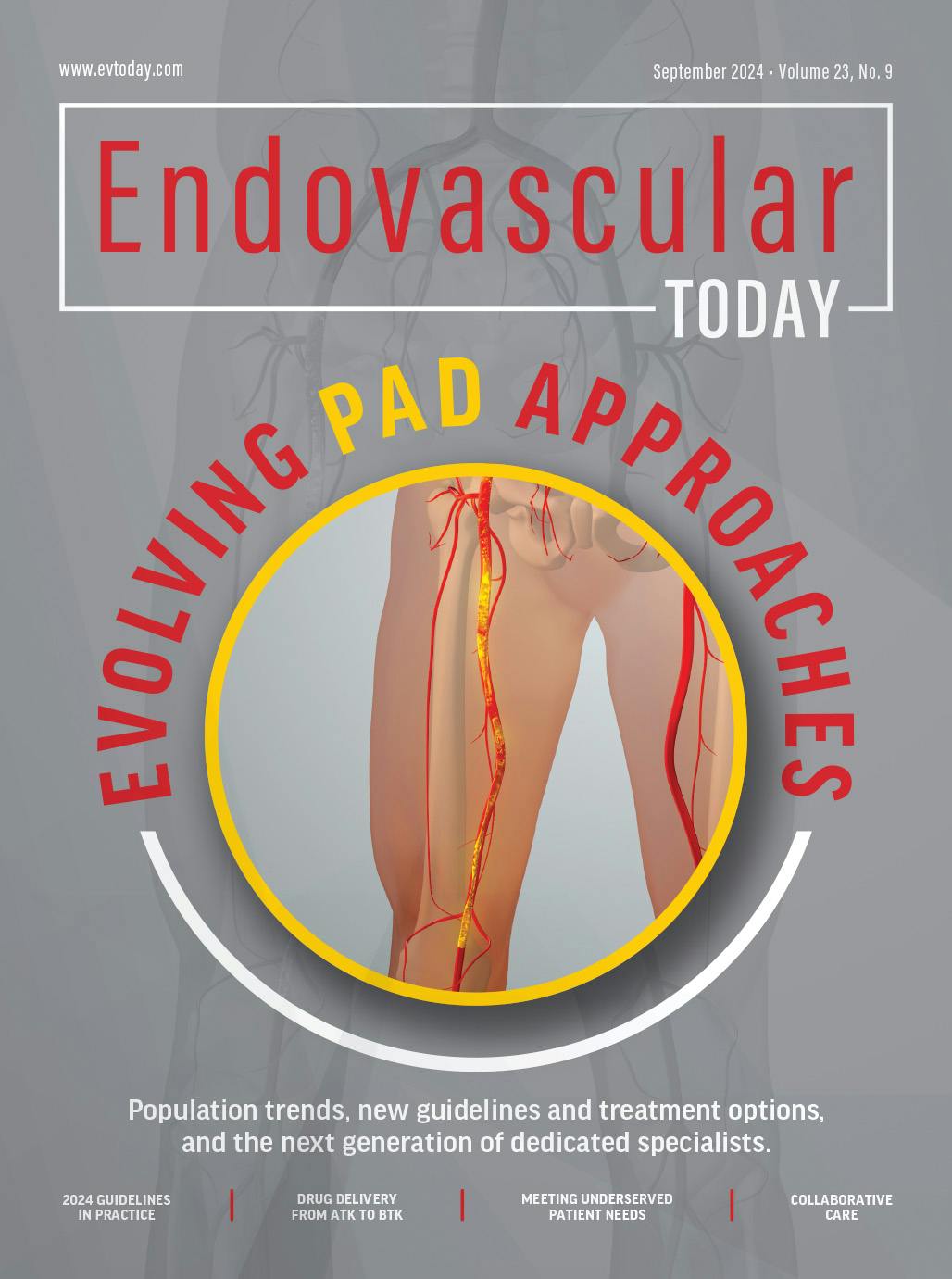 Koya Medical’s Dayspring Active Compression Device Evaluated in Studies ...