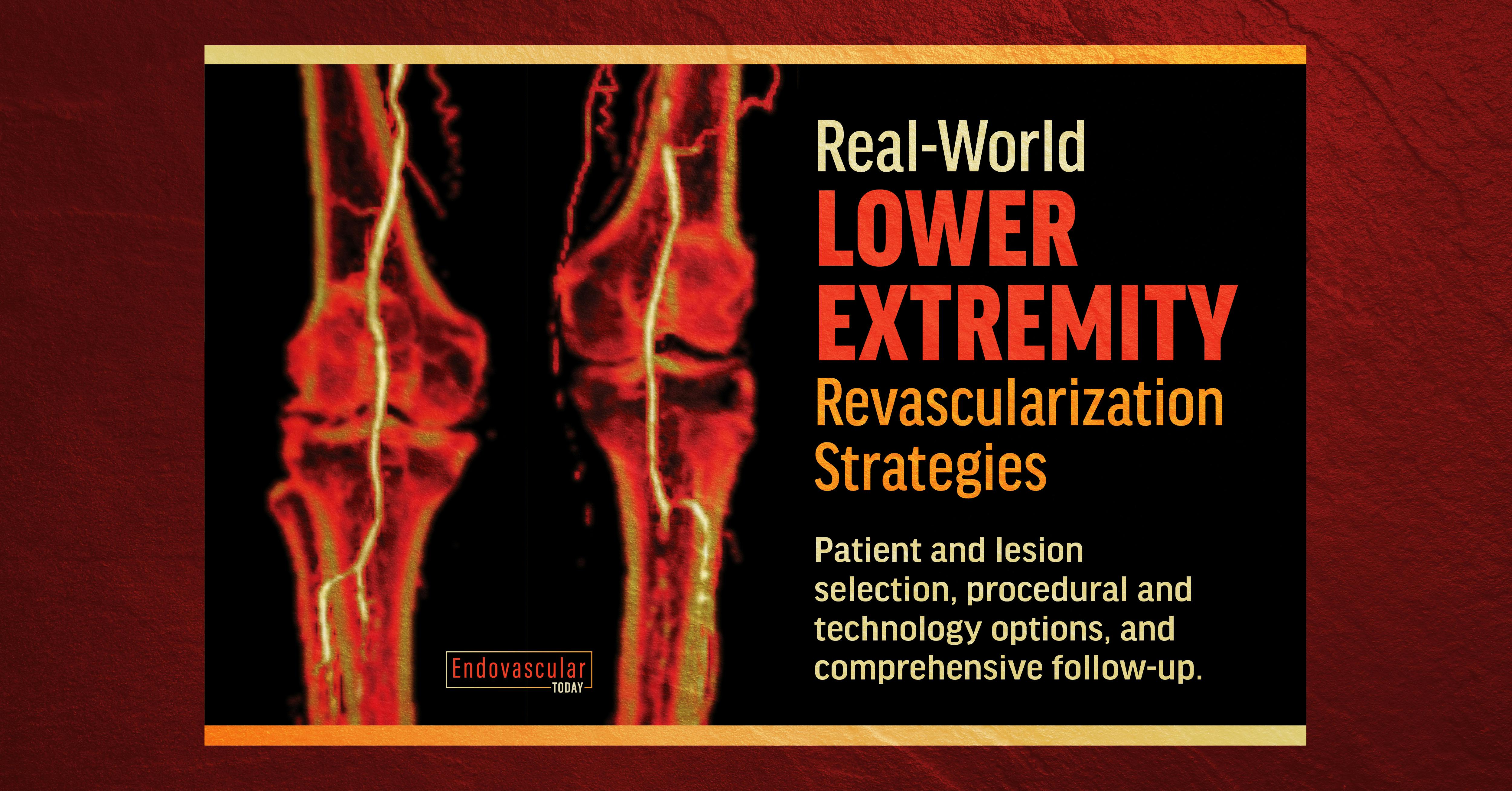 Real-World Lower Extremity Revascularization Strategies - Endovascular ...