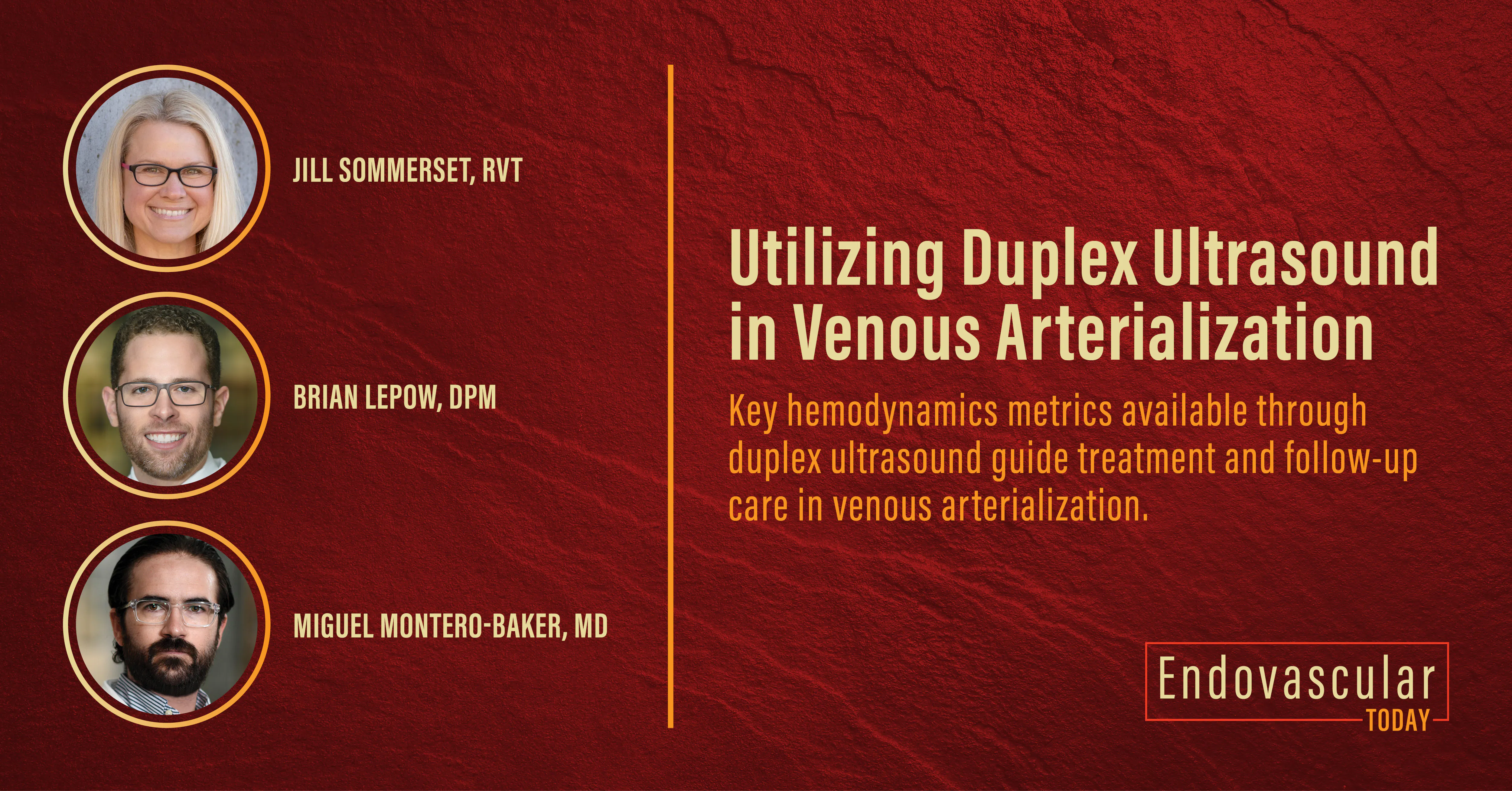 Utilizing Duplex Ultrasound in Venous Arterialization - Endovascular Today
