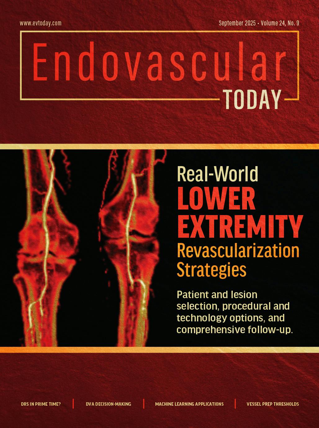 Koya Medical Dayspring Compression Device Evaluated in TEAYS Study for ...