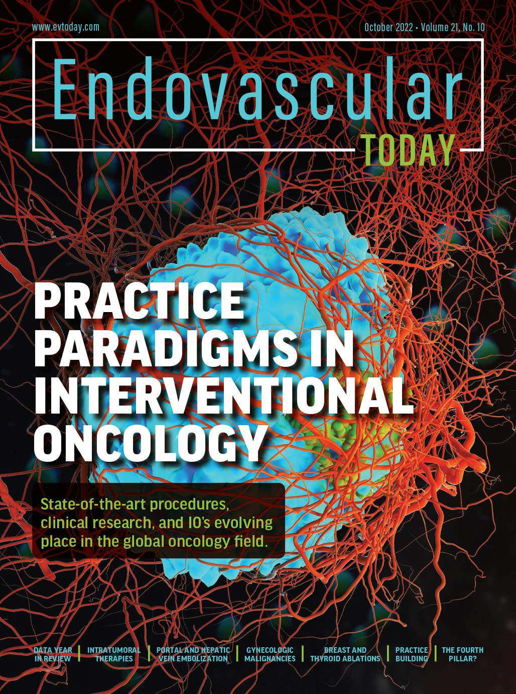 An Interview With James Milburn, MD, FACR - Endovascular Today