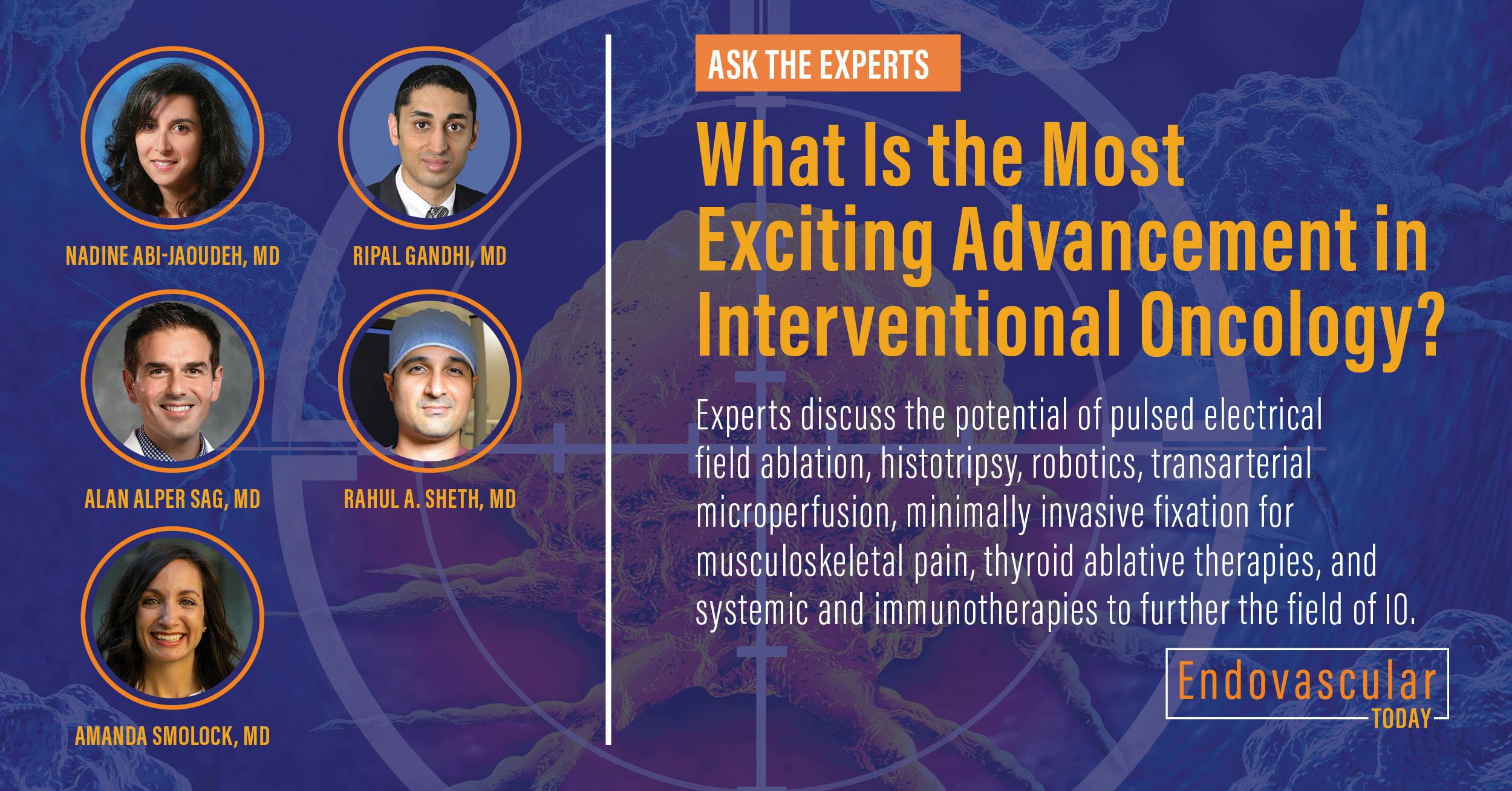 What Is the Most Exciting Advancement in Interventional Oncology ...
