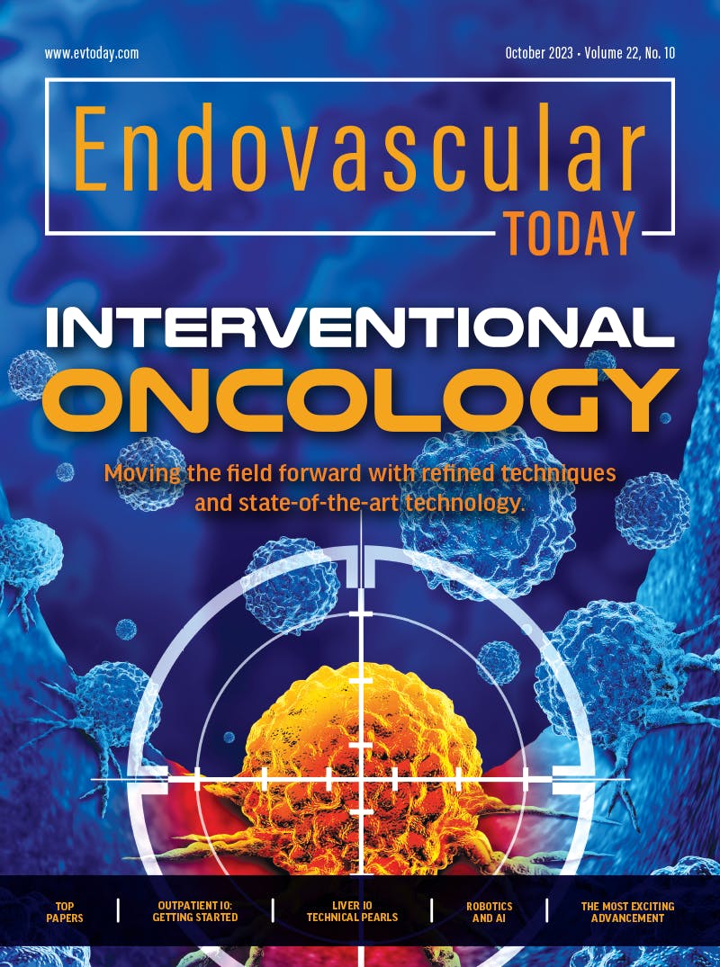 Baroreflex Activation Therapy: A Novel Extravascular Procedure for ...