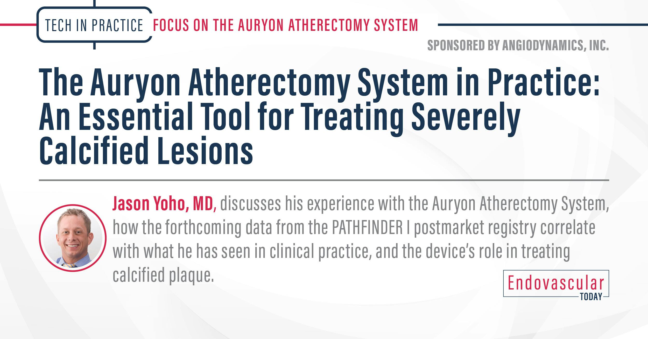 The Auryon Atherectomy System in Practice: An Essential Tool for ...