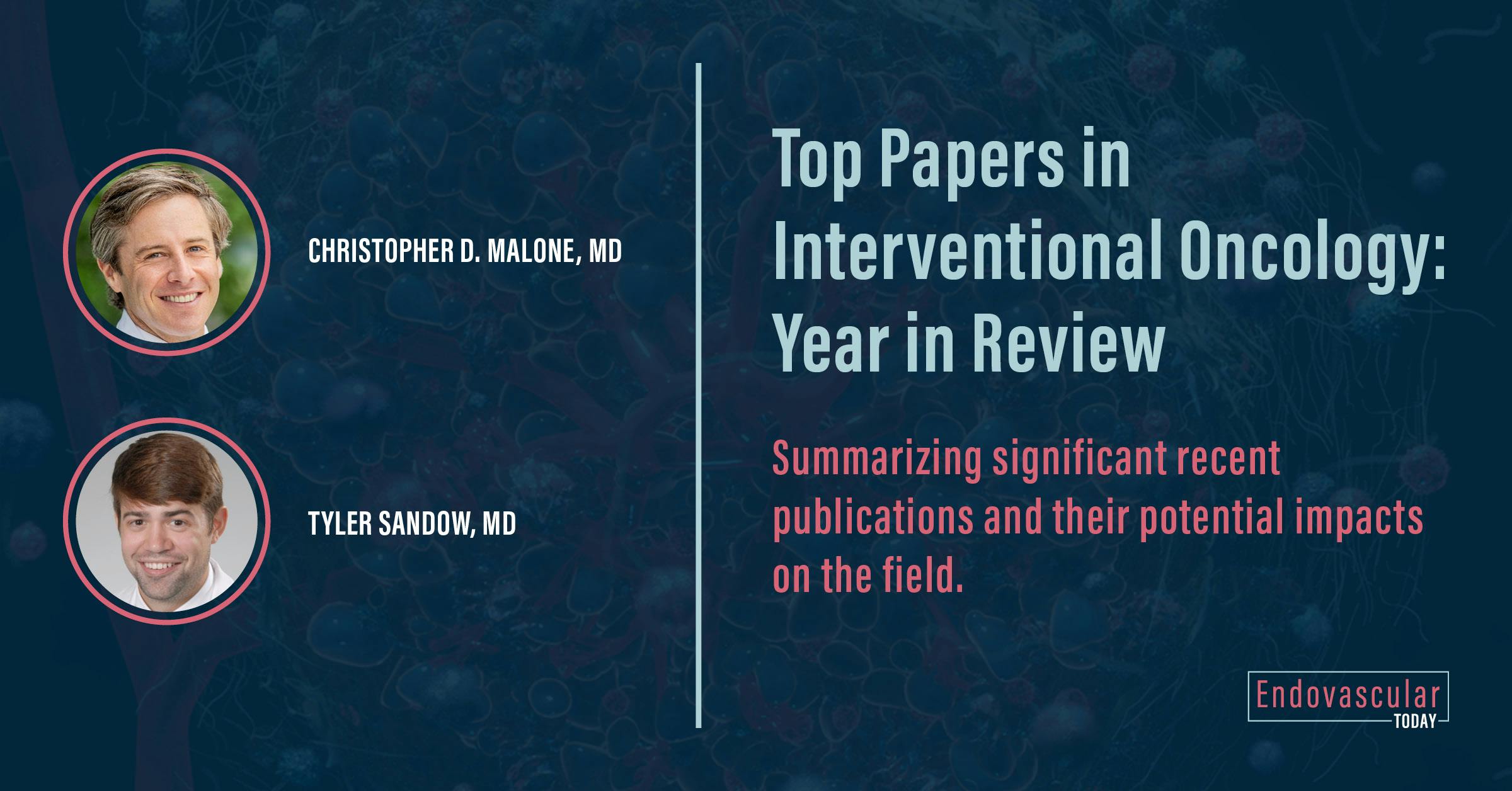 Top Papers in Interventional Oncology: Year in Review - Endovascular Today