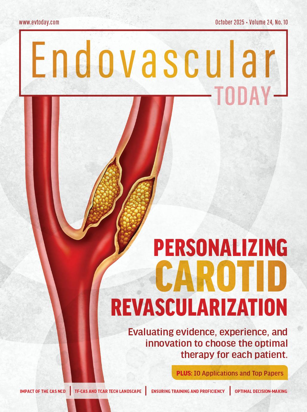 Koya Medical Dayspring Compression Device Evaluated in TEAYS Study for ...