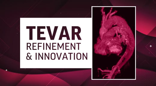 TEVAR Refinement and Innovation - Endovascular Today
