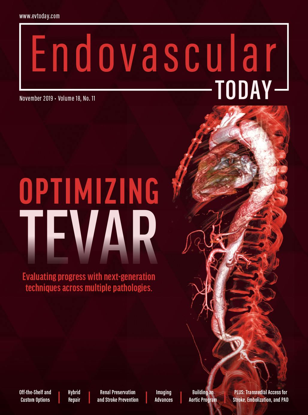 Strategies for Stroke Prevention During TEVAR: From Embolic Protection ...