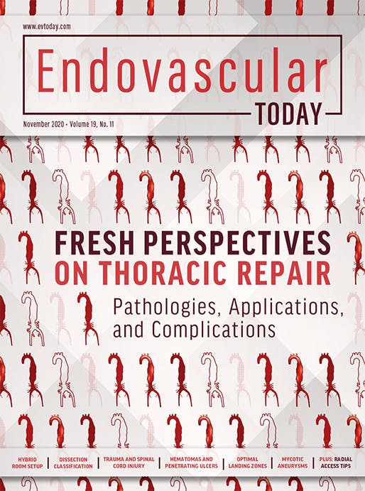 Optimal Landing Zone for TEVAR - Endovascular Today