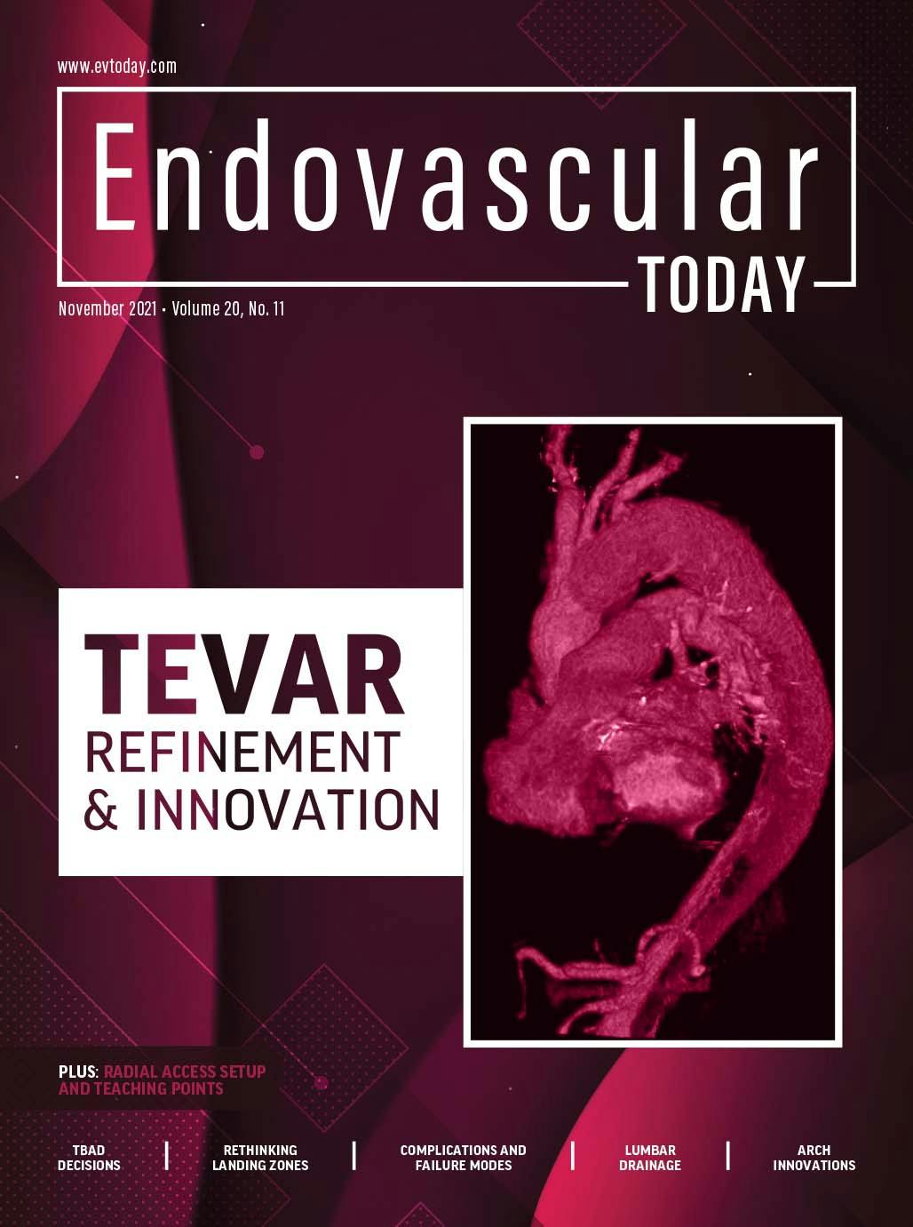 What Is Your Radial Access Cocktail, and Why? - Endovascular Today