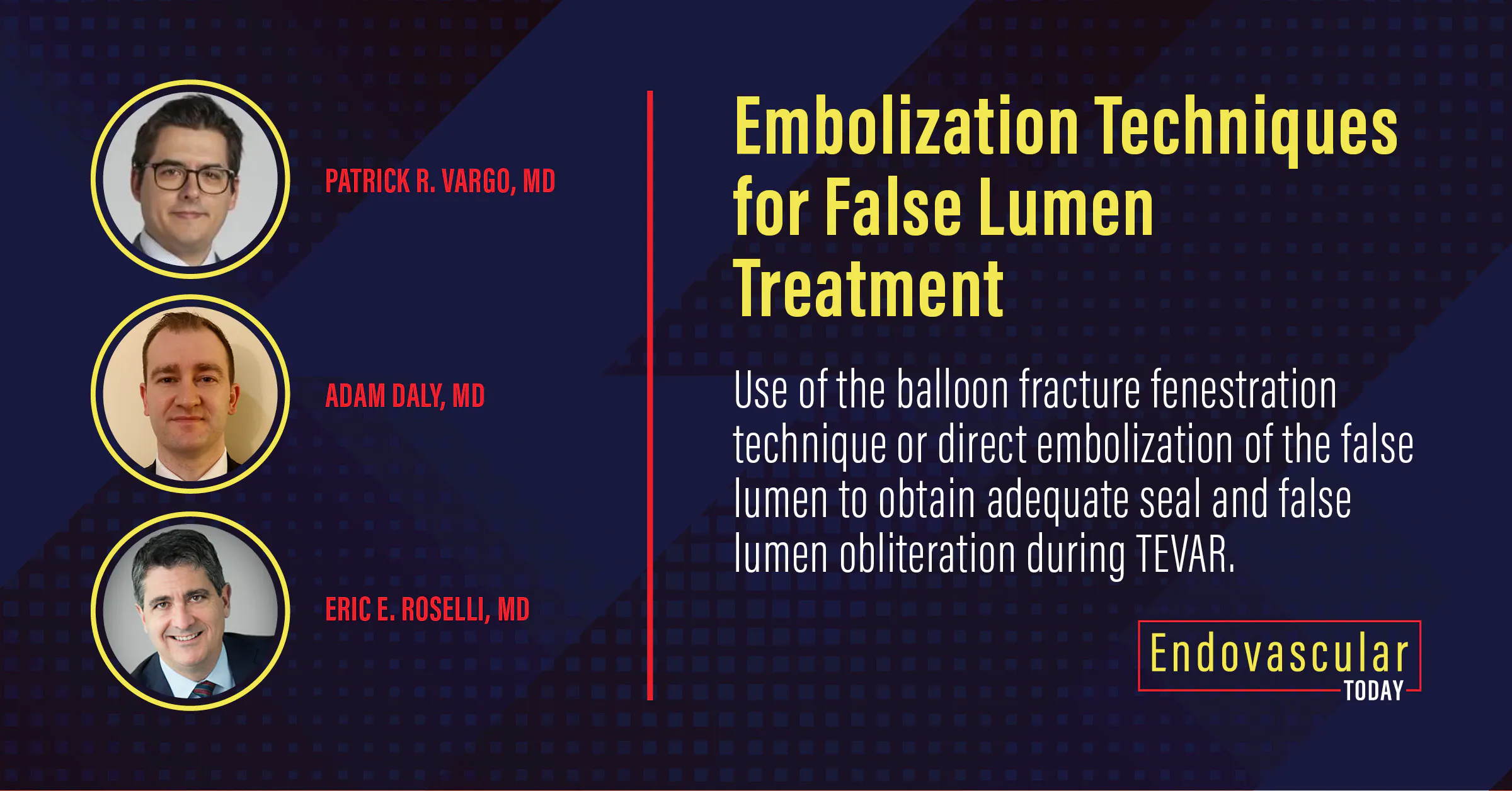 Embolization Techniques for False Lumen Treatment - Endovascular Today