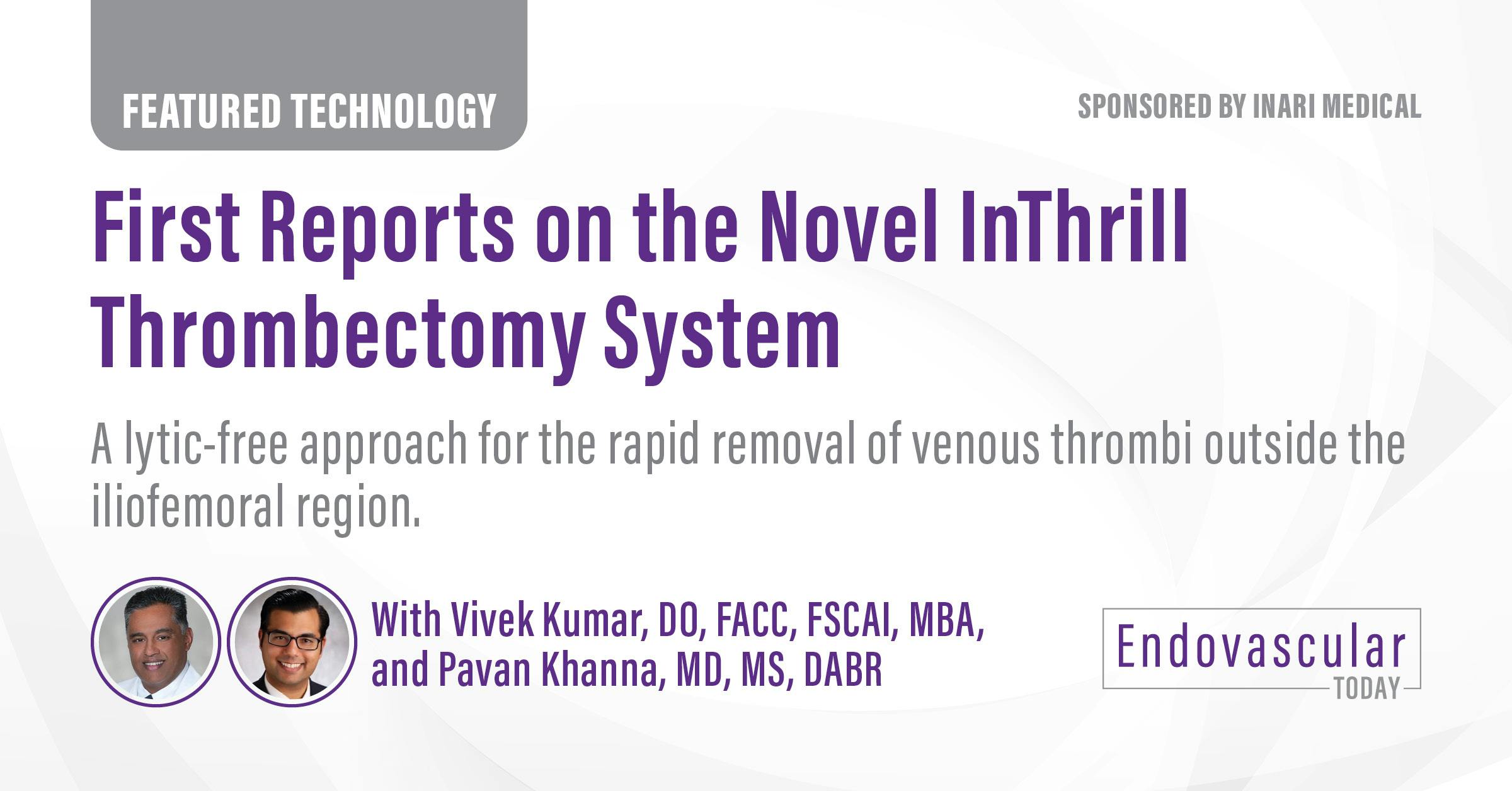 First Reports on the Novel InThrill Thrombectomy System - Endovascular ...