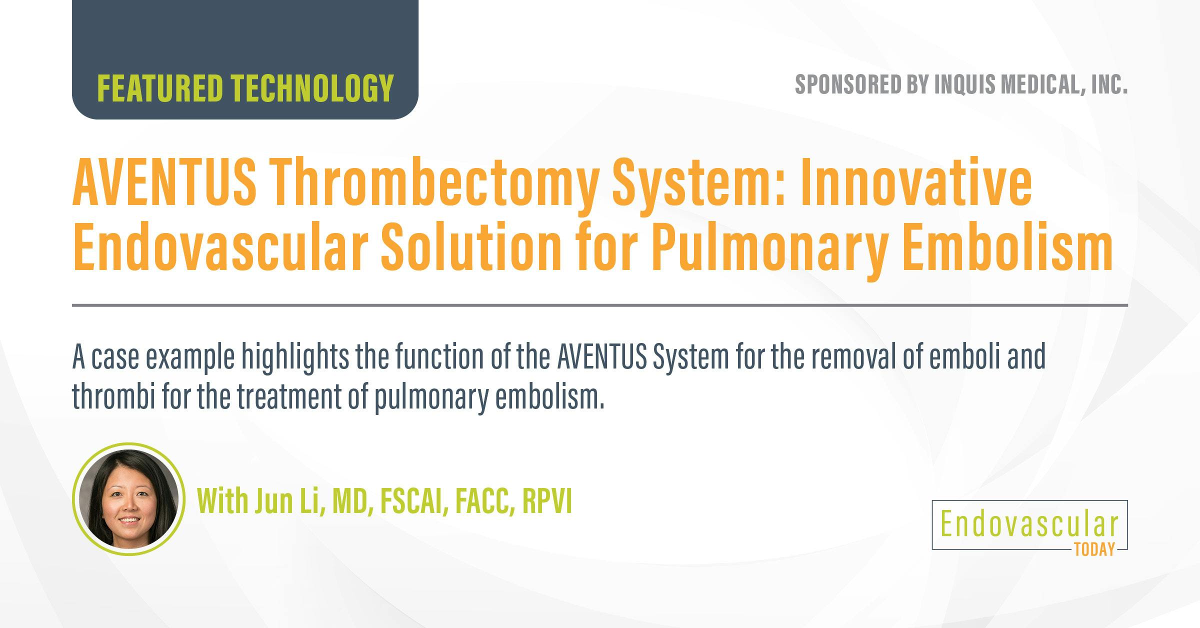 AVENTUS Thrombectomy System: Innovative Endovascular Solution for ...