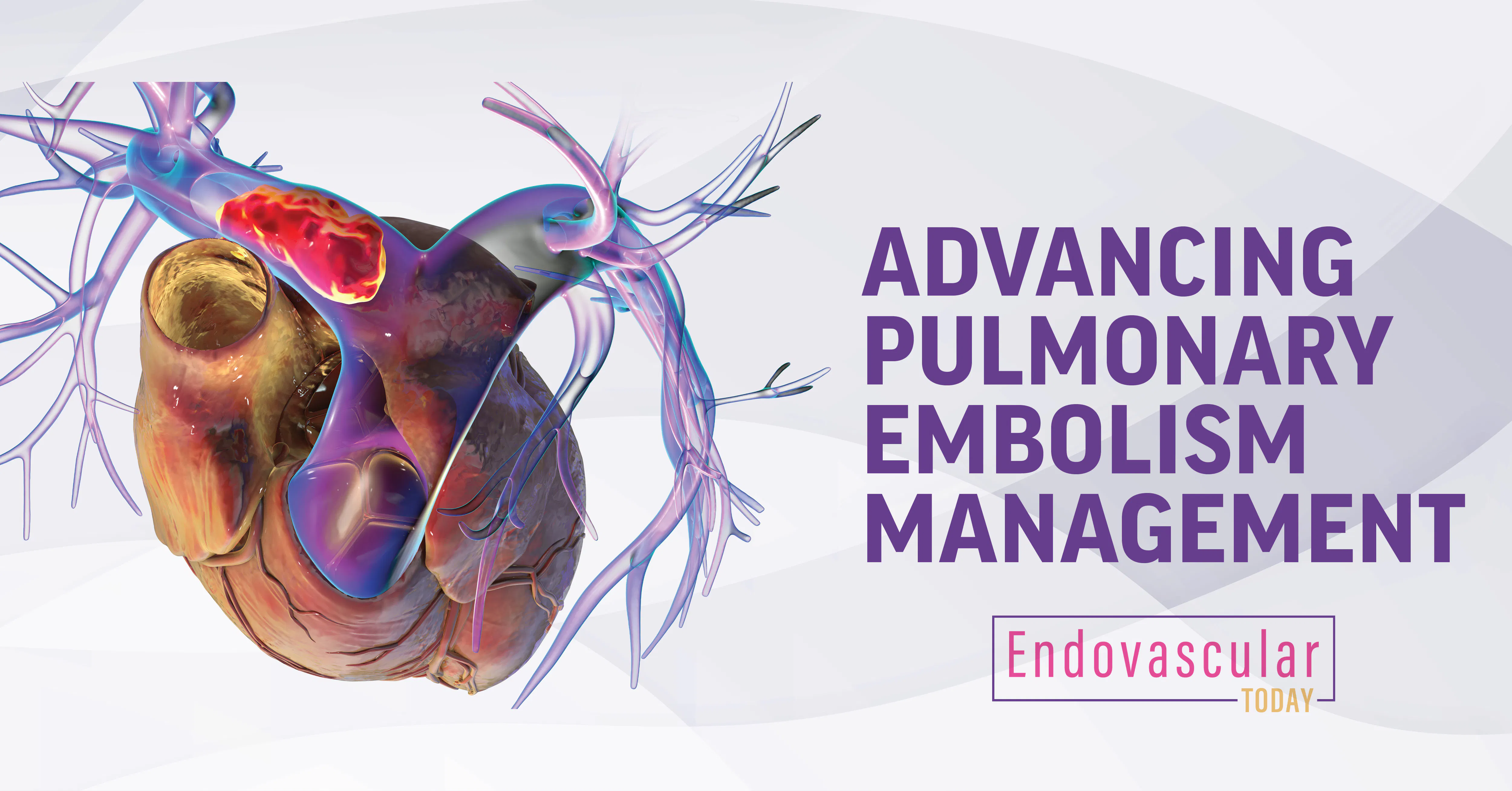 Advancing PE Management - Endovascular Today