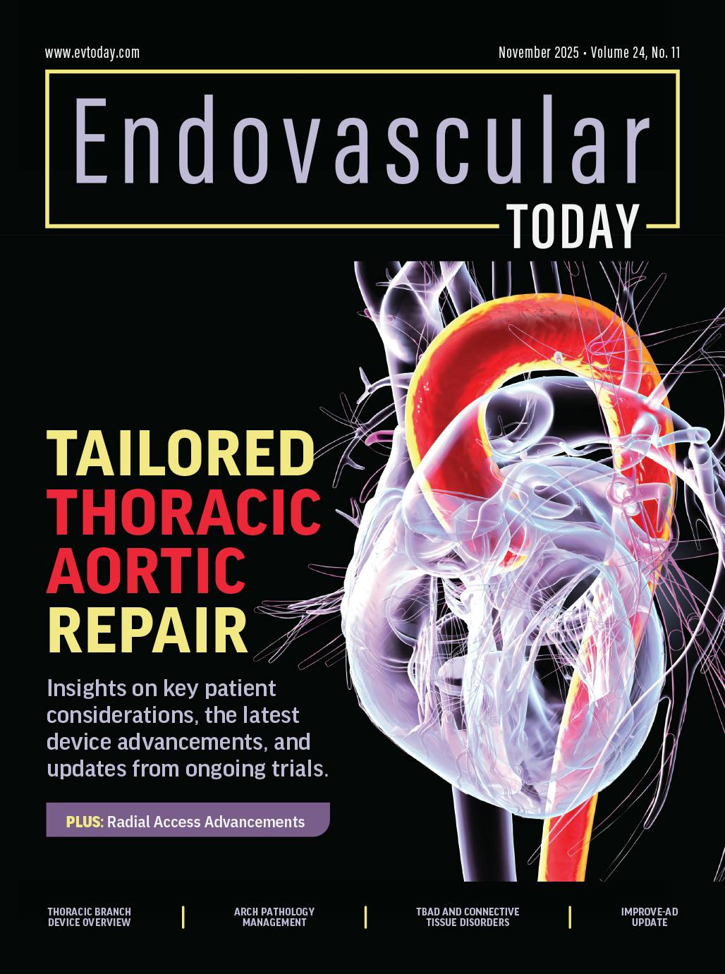 Simcere’s Sanbexin Before Thrombectomy Studied to Improve Outcomes ...