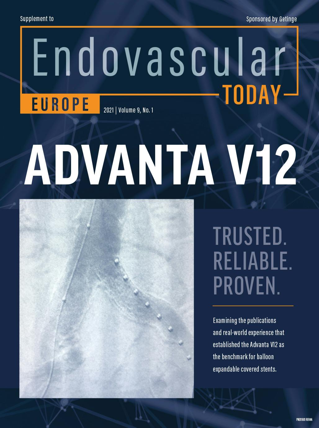 Advanta V12: A Balloon Expandable Covered Stent Worth My Trust - Endovascular Today