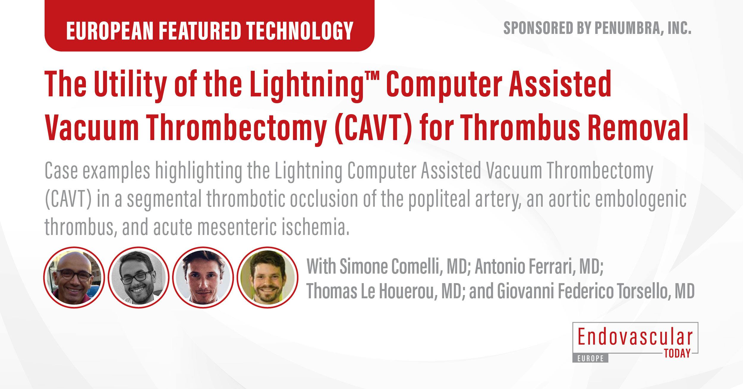 The Utility of the Lightning™ Computer Assisted Vacuum Thrombectomy ...