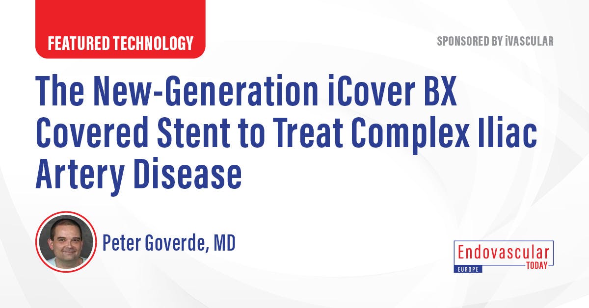 The New-Generation iCover BX Covered Stent to Treat Complex Iliac ...