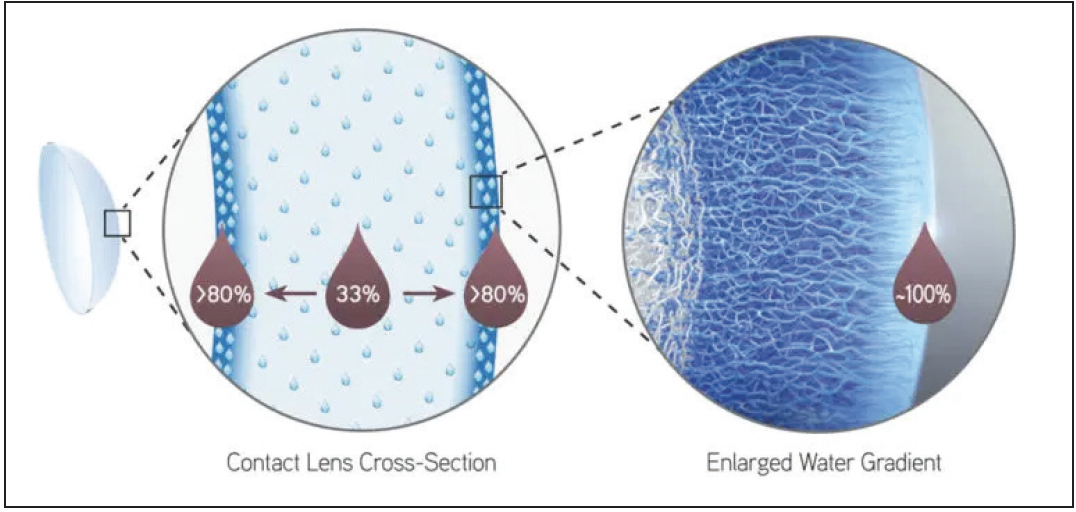 Contact Lens Conversations - Modern Optometry