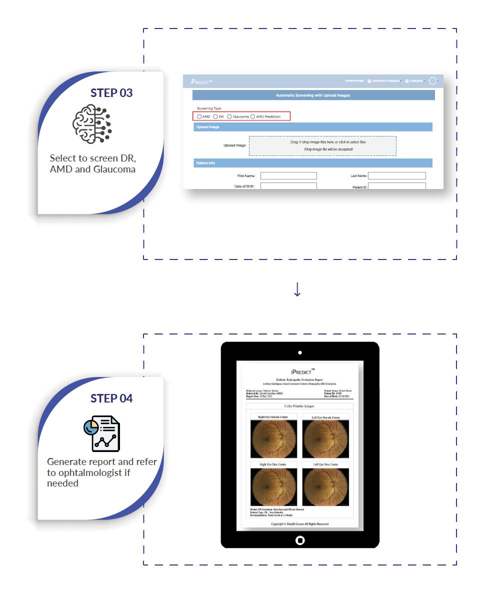 iHealthScreen Awarded US Patent on Glaucoma Detection Based on AI and ...