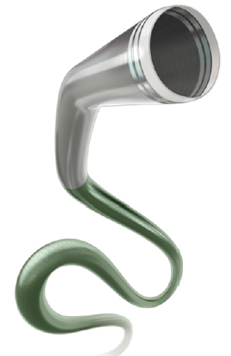 Rethinking Thrombus Removal With the Indigo System: Introducing ...