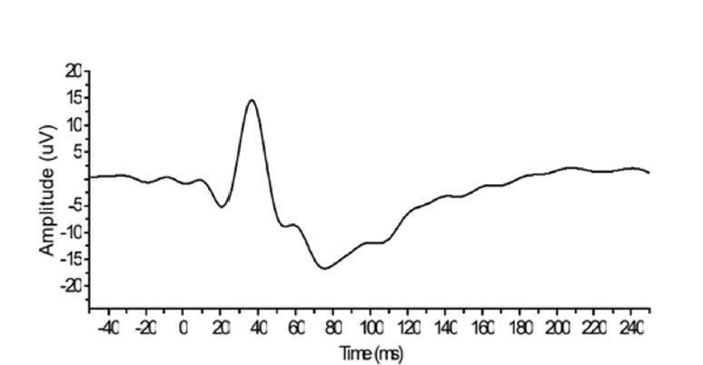 Taking Electroretinography to the Next Level - Modern Optometry