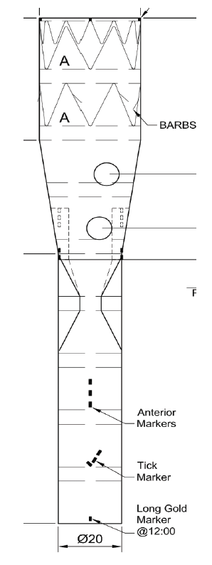 Modern Complex Stent Graft Designs: A Closer Look - Endovascular Today