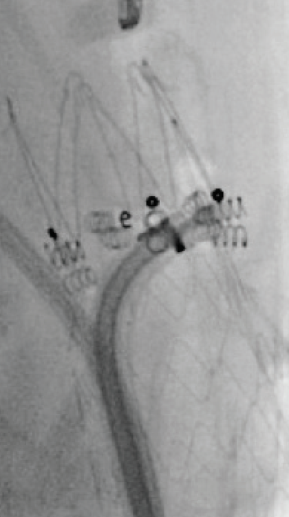 Off-the-Shelf Solutions to Treat a Short Neck: A Data Overview and Case ...