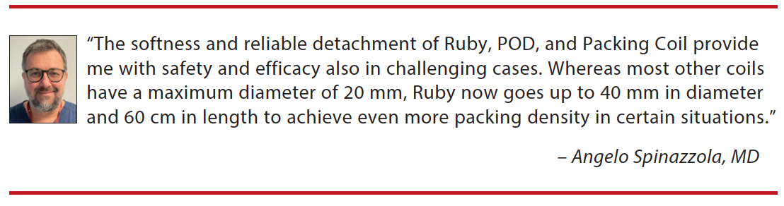 Ruby®, POD®, and Packing Coil: Immediate and Long-Term Mechanical ...