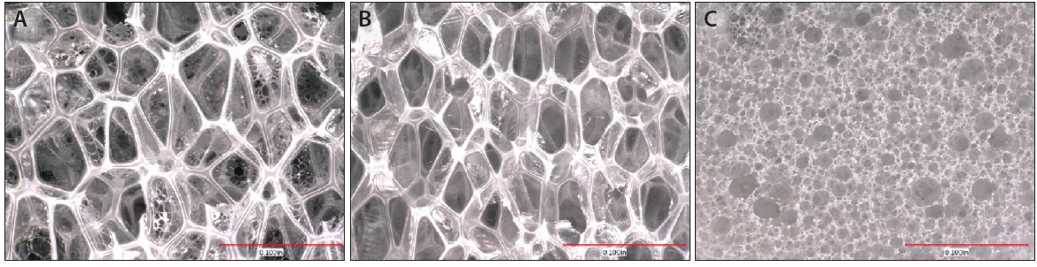 Shape Memory Polymer Technology - Endovascular Today