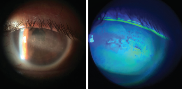Urgent or Emergent? - Modern Optometry