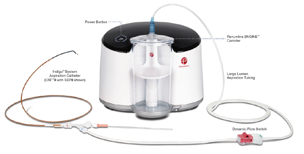 Mechanical Power Aspiration With the Indigo® System in Pulmonary Emboli ...