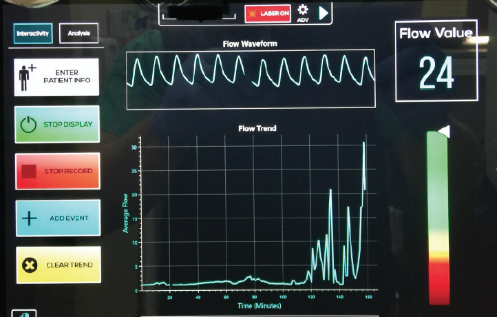 Time to Stop Doing Angiography in the Dark: The FlowMet™ Peripheral ...