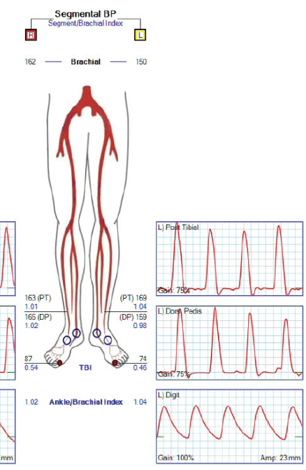 Time to Stop Doing Angiography in the Dark: The FlowMet™ Peripheral ...