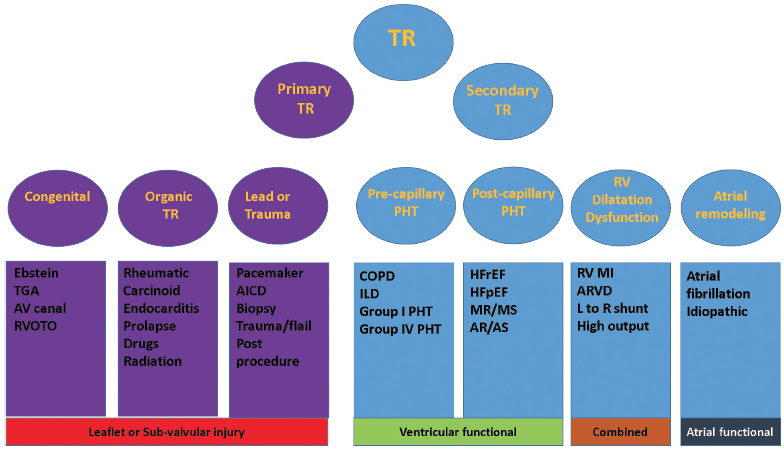 From Neglected to Noticed: A Contemporary Understanding of Tricuspid ...