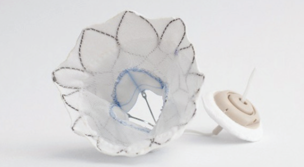 Perspectives on Transcatheter Mitral Therapy - Cardiac Interventions Today