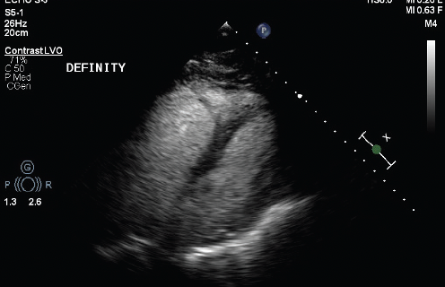 PERT Development and Implementation to Standardize Patient Pathway for ...