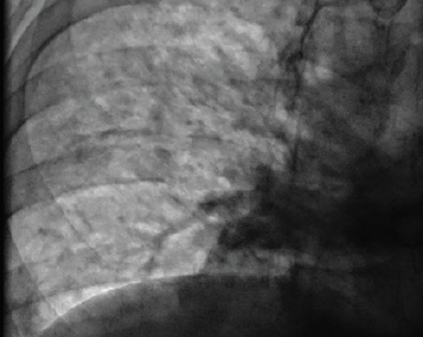 PERT Development and Implementation to Standardize Patient Pathway for ...