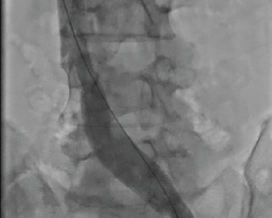 PERT Development and Implementation to Standardize Patient Pathway for ...